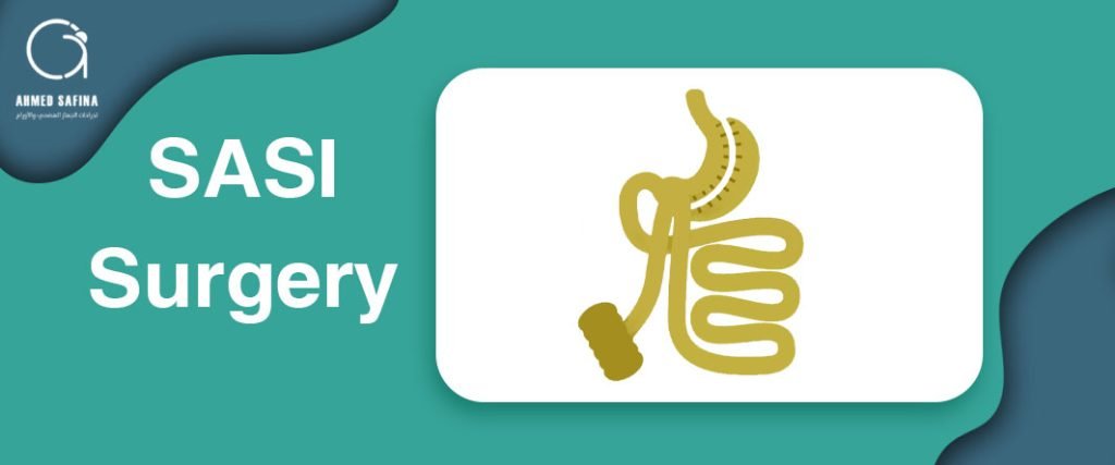 Dr.Ahmed Safina | SASI Surgery